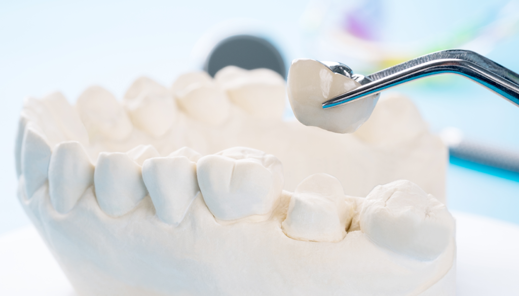 PROSTHODONTICS AND ESTHETIC – DAHAN DENT